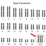 Sindrom Triplu X - Trisomia X