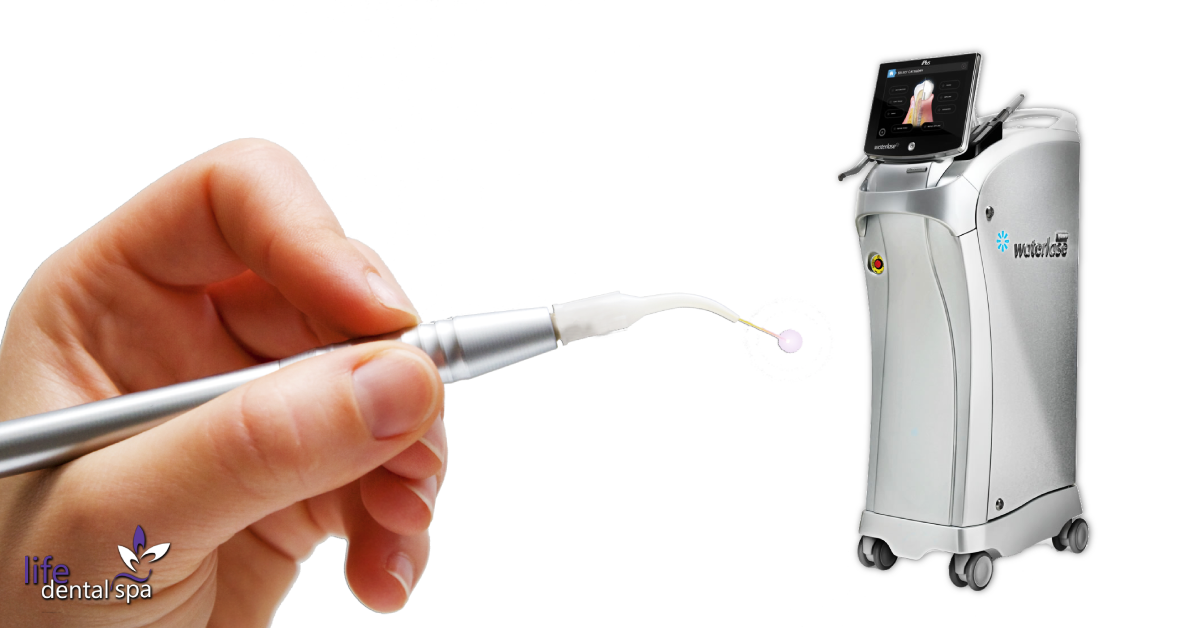 De ce sa alegi tratarea cariilor cu laserul?