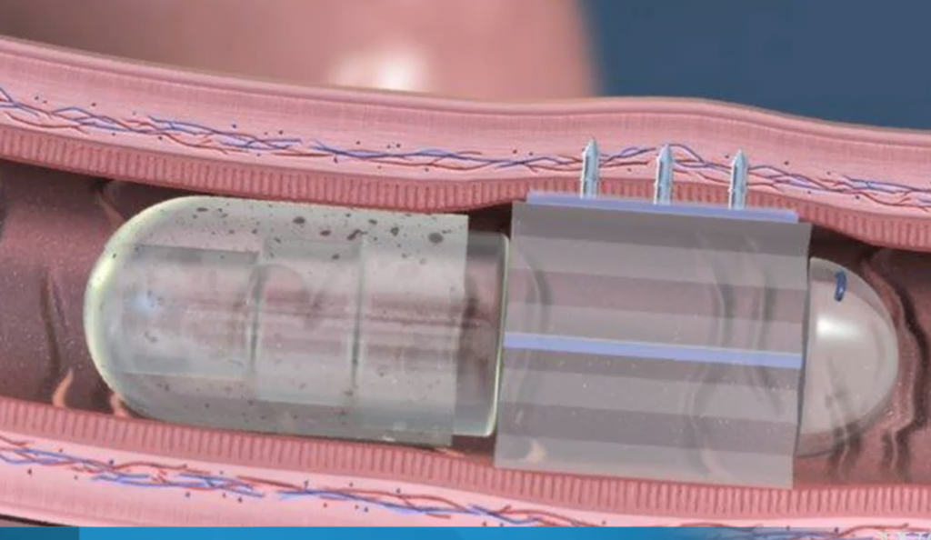 Pastila care ar putea înlocui pe viitor injecțiile