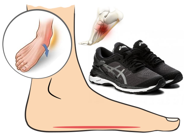 Alergarea cu picior plat (platfus)