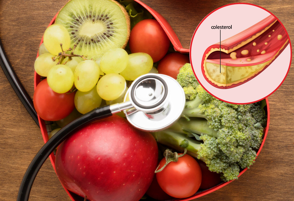 Analiză: Cum scădem LDL-colesterolul prin dietă și medicație