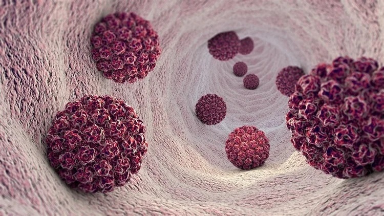 Impactul infecției HPV asupra microflorei vaginale și rolul în cancer ...