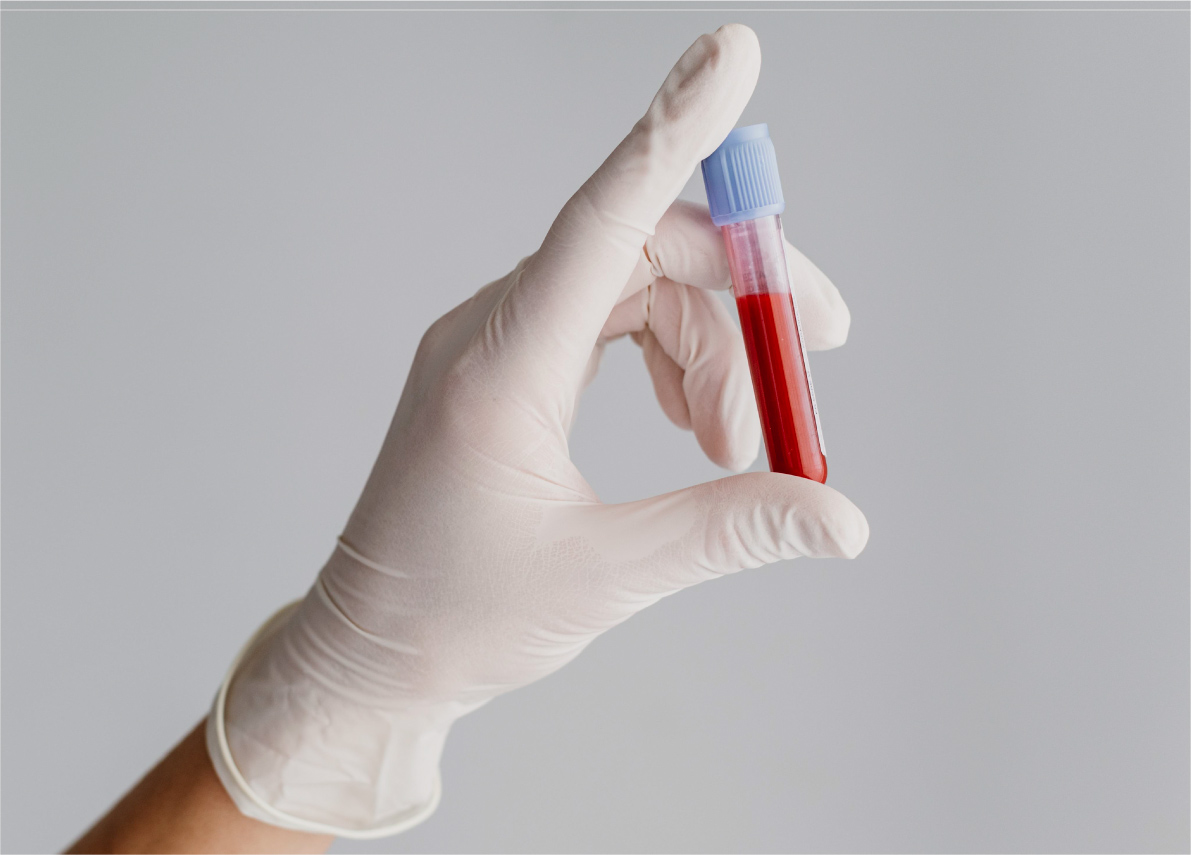 Anticoagulantele moderne reduc riscul de sângerare