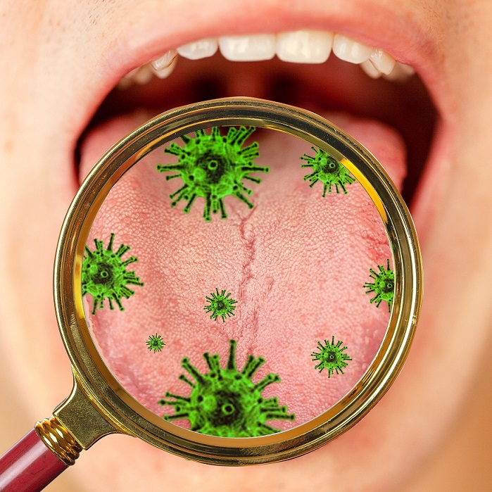 Aspectul limbii - element de diagnostic facil cu AI