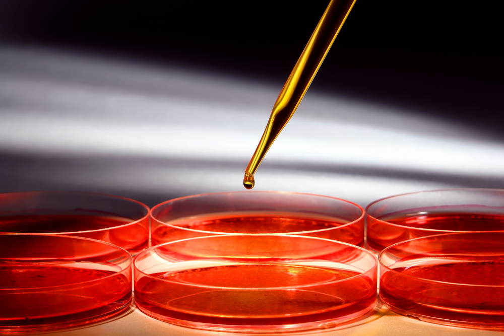 Leucocitoza cu limfopenie (leucocite crescute cu limfocite scăzute)