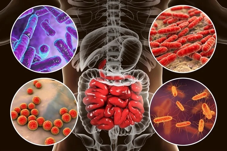 Rolul microbiomului intestinal și al disbiozei microbiene în bolile ...