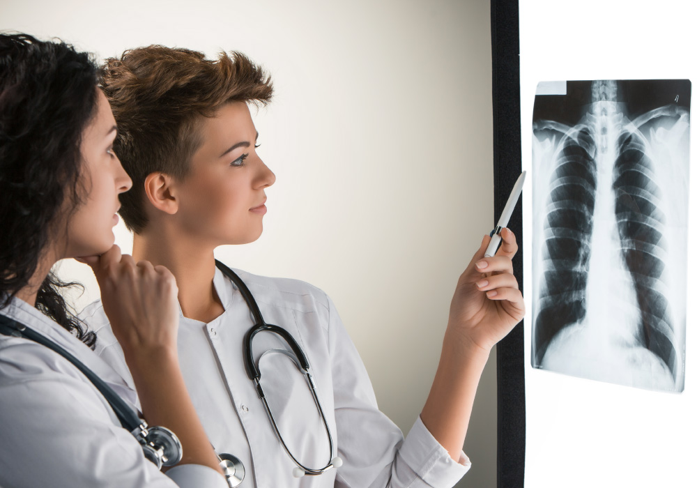 Fibroza pulmonară post-COVID-19 - prognostic mai bun decât cea idiopatică