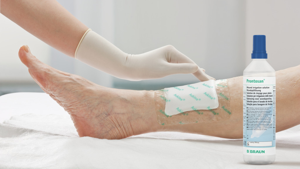 Tratamentul ulcerului varicos: Integrarea soluției și gelului Prontosan ...