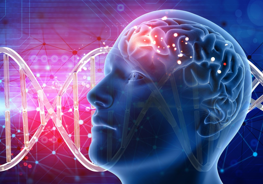 Terapia celulară combinată cu factorul neurotrofic derivat din creier ...
