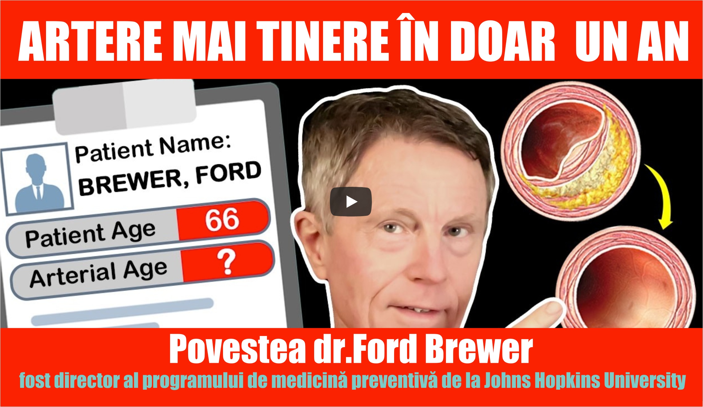 Cum și-a curățat arterele (de aterom) în doar un an - povestea dr. Ford ...