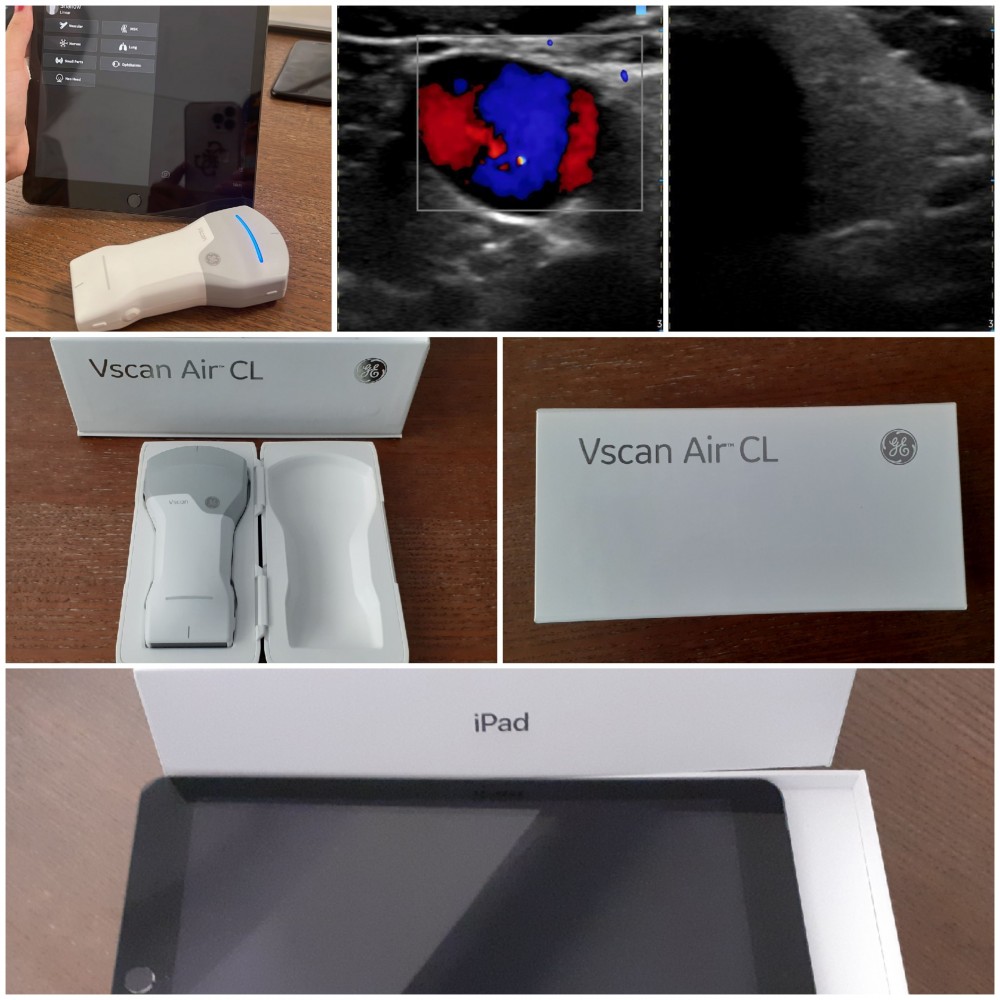 Ecograf portabil Vscan Air | Anunturi medicale Bucuresti