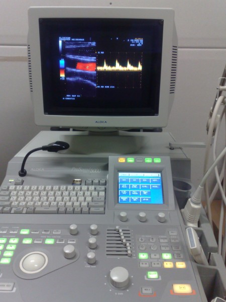 Ecografe Aloka SSD-5000 B,M,CW,PW, doppler color, Powerdoppler ...