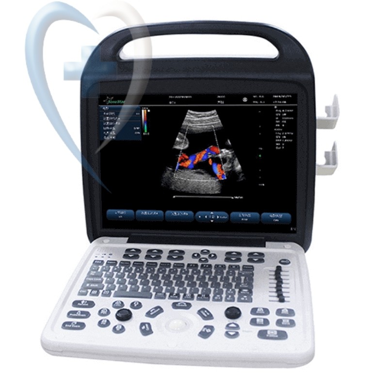 ECOGRAF TIP LAPTOP, C10M Color Doppler System (40 channel) | Produse ...
